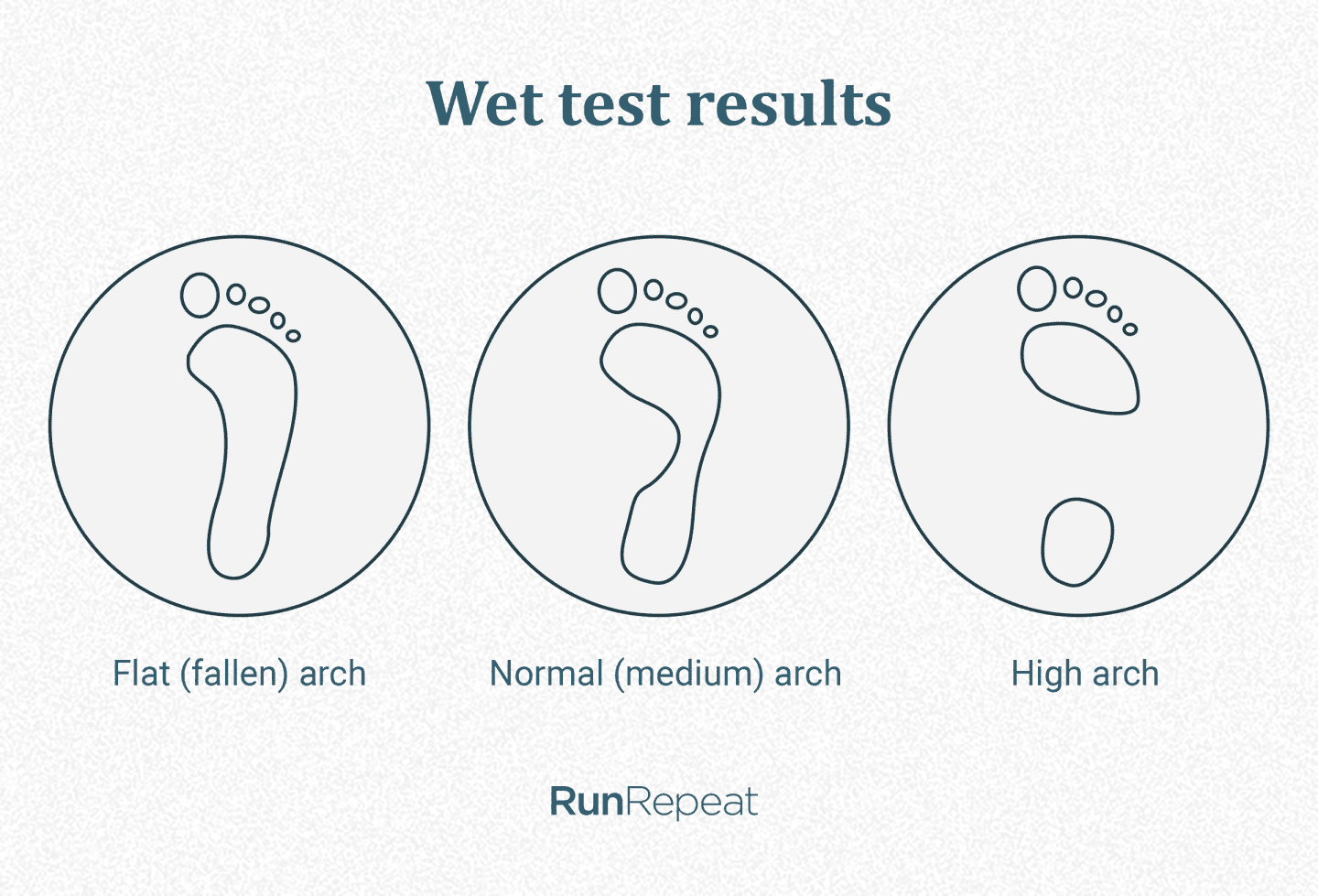 Arch Support for Runners: What, How and Why [In-Depth Guide] | RunRepeat