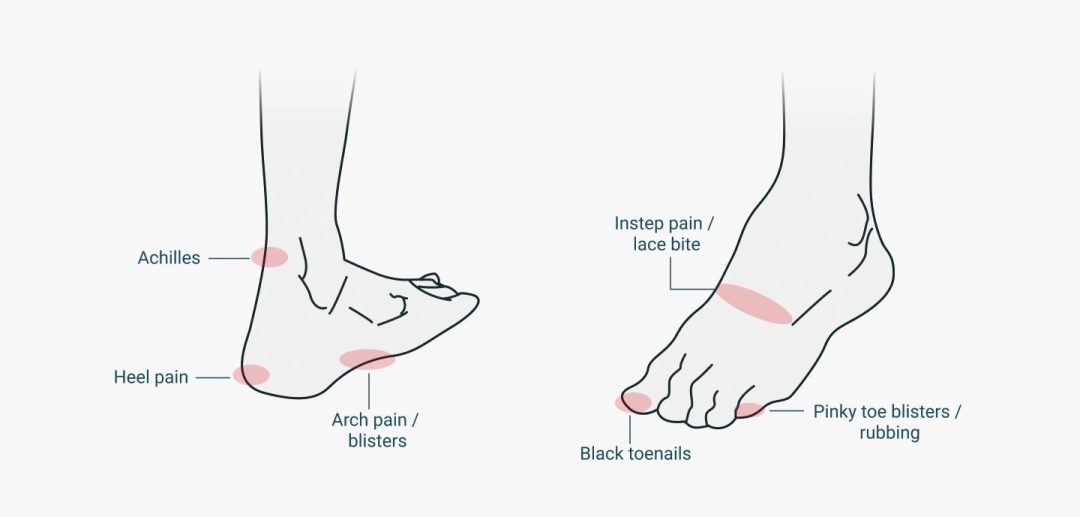 Running shoe upper: how to choose the best one for your needs | RunRepeat