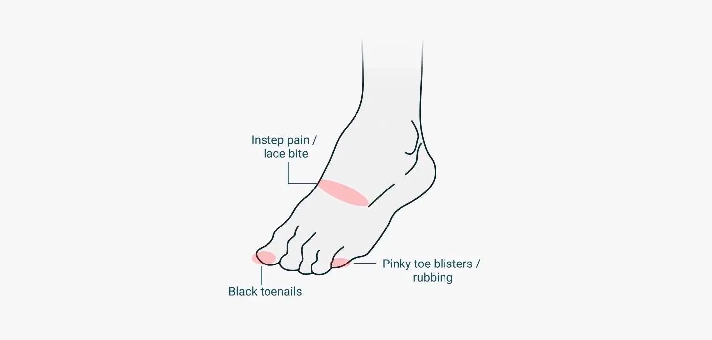 A runner's guide to choosing the right toebox | RunRepeat